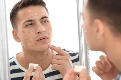 UNDERSTANDING ACNE: CAUSES AND TREATMENT OPTIONS - Dermatology Associates